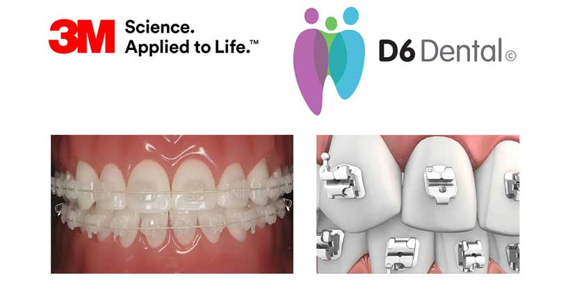 Orthodontic Excellence from 3M Oral Care