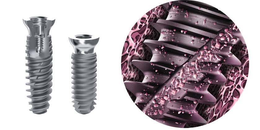 Anthogyr Implant Solutions