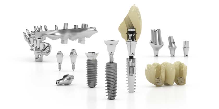 Losing Teeth, Mental Health, Anthogyr implants