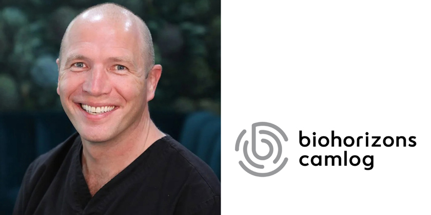 Tapered Pro Conical Implant