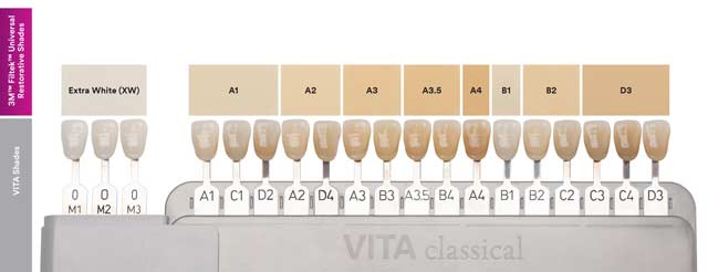 Filtek Universal Restorative