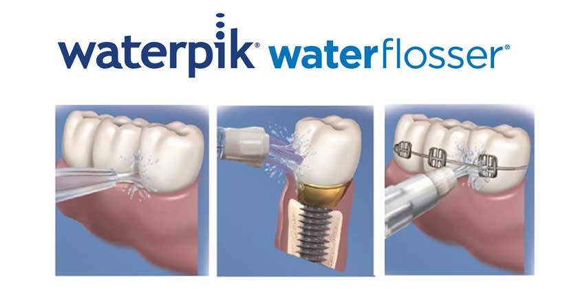 Waterpik Water Flosser: Gentle but Effective