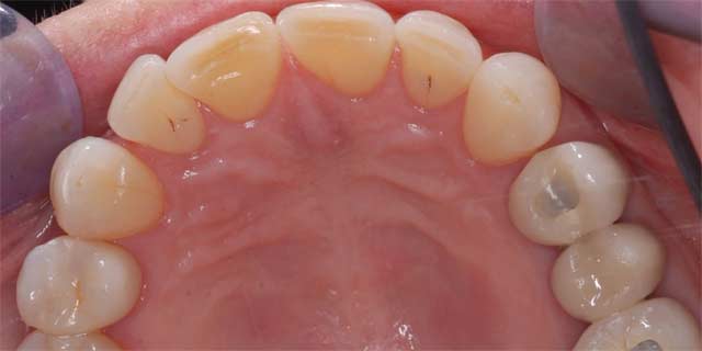 Dr Allan Matthews: Align, Bleach and Bond