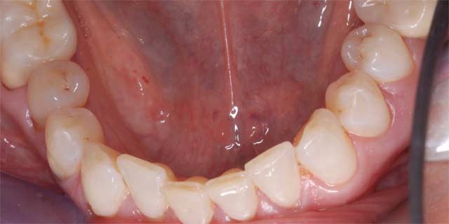 Dr Allan Matthews: Align, Bleach and Bond