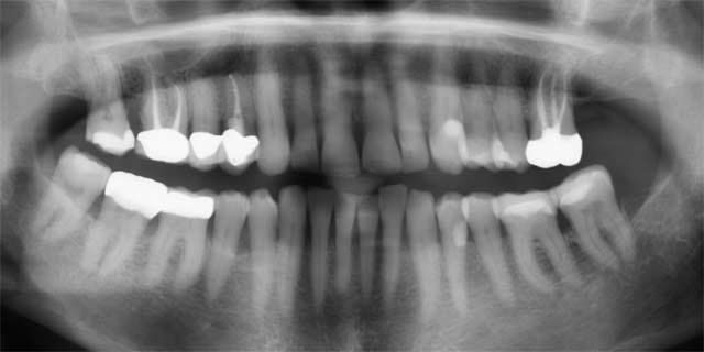 Dr Allan Matthews: Align, Bleach and Bond