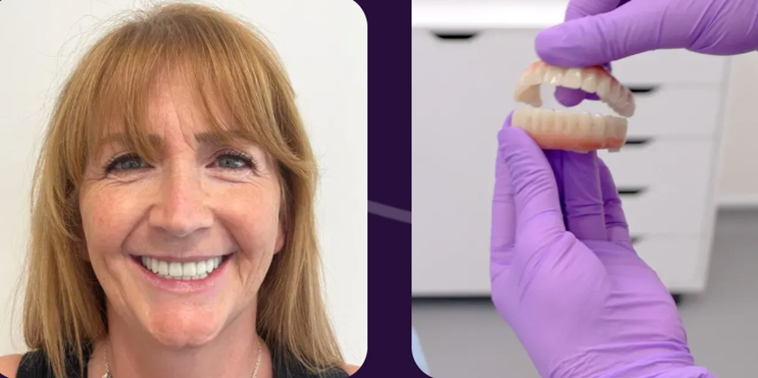 21D: Dental Implant Costs