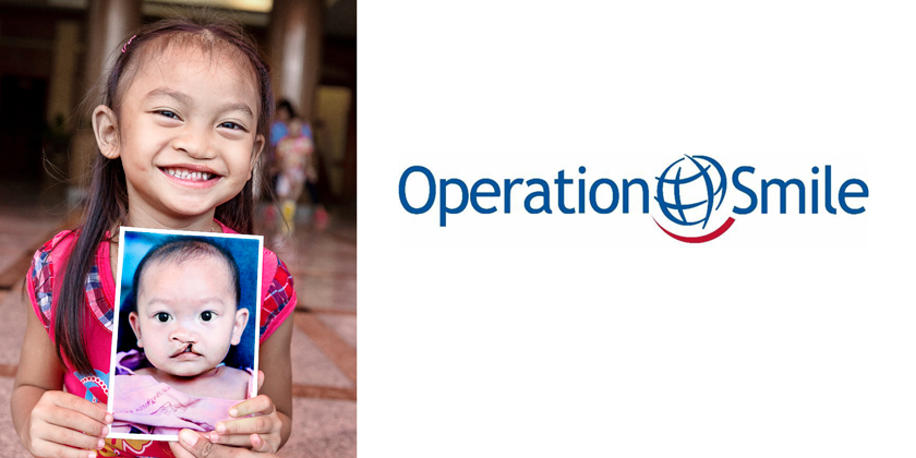 Operation Smile Benefits