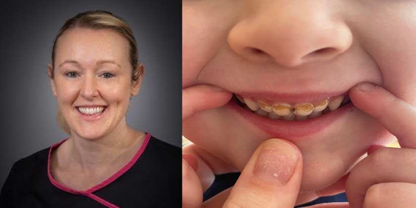 Kelly Woodward: Poor Child Oral Health