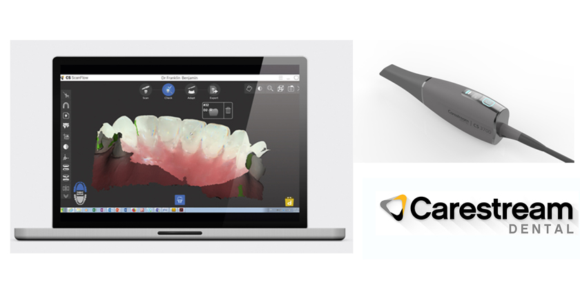 High-Performance Intraoral Scanning with CS 3700