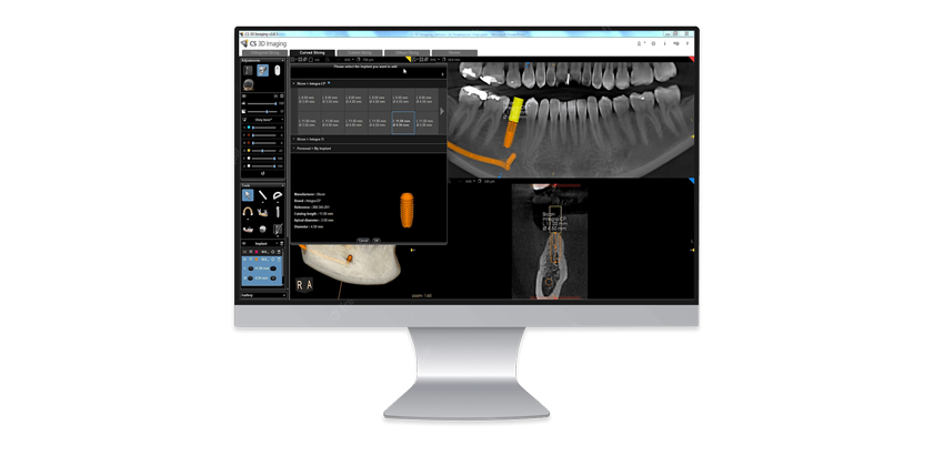 CS 3D Imaging Software