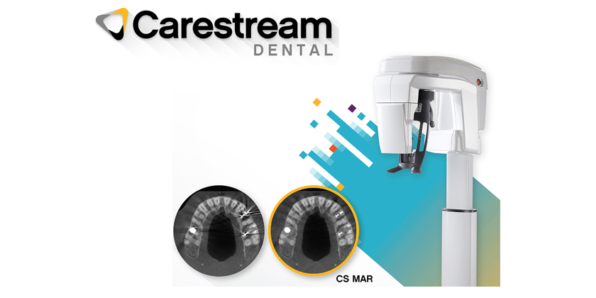 CS 8100 3D Evo Edition