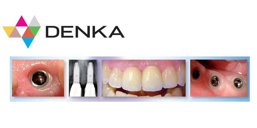 Denka: The Trusted Dental Supplier