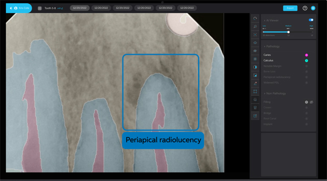 Pearl AI ‘Refocusing Dentistry’