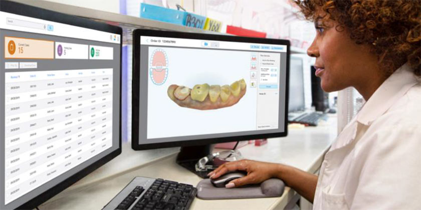 Align Launches New MyiTero Lab Workflow