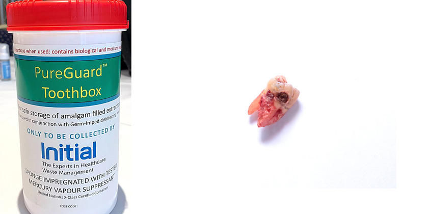 Initial Medical Anatomical Waste