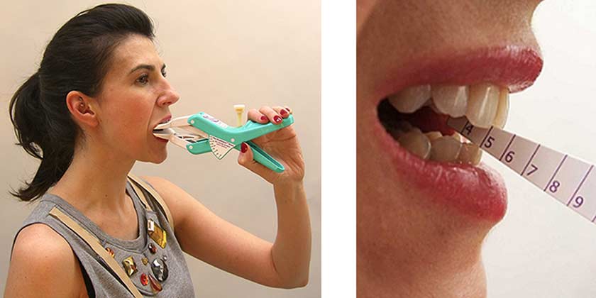 OraStretch from Total TMJ